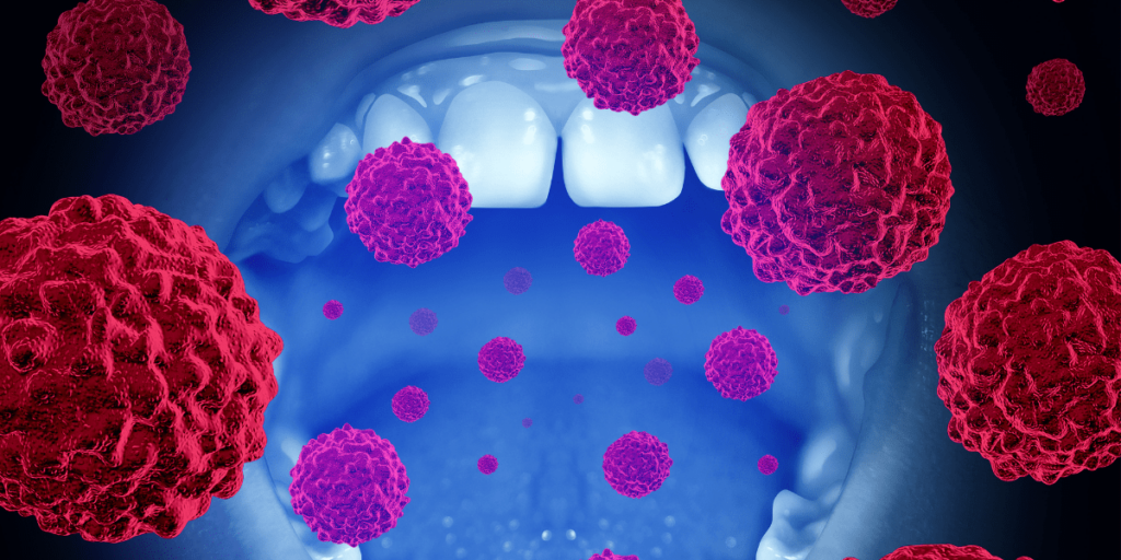 How Oral Cancer Screenings Can Save Your Life RenovaSmiles How Oral Cancer Screenings Can Save Your Life RenovaSmiles